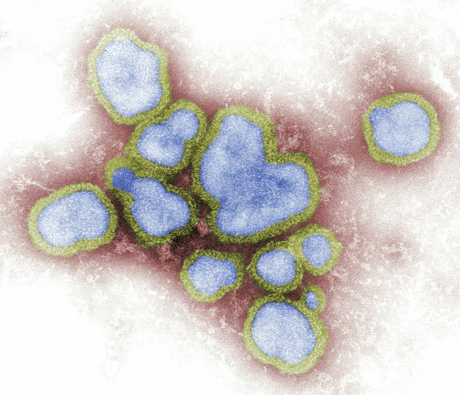 virusos - Understanding Viral Infections and Their Impact